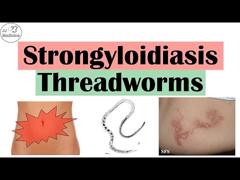 Strongyloidiasis (Threadworms) | Causes, Pathophysiology, Signs and Symptoms, Diagnosis, Treatment