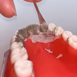 🦷✨ Premium Stainless-Steel Dental Cleaning & Metal Toothpick Set – Keep Your Smile Fresh & Clean Anytime! अब दाँतको हेरचाह घरमै प्रोफेशनल स्तरको! यो स्टेनलेस स्टील डेन्टल टुल सेट ले तपाईंलाई दिन्छ सफा, चम्किलो र स्वस्थ दाँतको अनुभूति—कुनै पनि समयमा, जहाँ पनि! 🌟 मुख्य विशेषताहरू / Key Features ✅ High-Quality Stainless Steel – जंग नलाग्ने, टिकाउ र लामो समयसम्म चल्ने ✅ Multiple Precision Tools – दाँत बीचको फोहोर, प्लाक, क्याल्कुलस सफा गर्न सजिलो ✅ Portable Metal Case – सानो, हल्का, ट्राभलमा पनि स