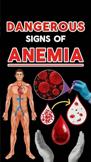 Warning Signs You're Anemic Right Now