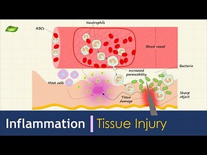 Inflammation in injury | Basic Science Series