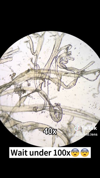 Magnificent Close-up of Beef Tripe Under a Microscope