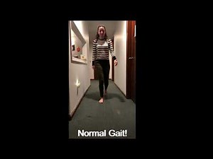 Antalgic Gait Demonstration