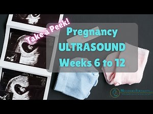 Take a Peek: Weeks 6 to 12 in Pregnancy Scans | Ultrasounds!