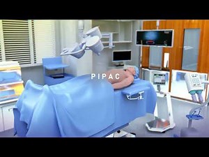 Introduction to PIPAC Treatment