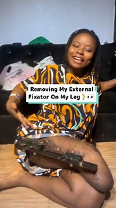 Removing the huge metal clamp on my leg 🦵👀 | Craft Factory