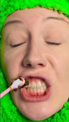 From Plain to Glam ✨ Tooth Gems Transformation