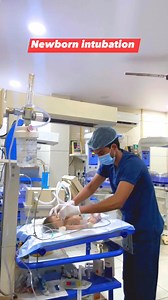 How to newborn intubation #baby #nicucare #baby #cutebaby #newborn #facebookpost #facebookvideo #facebookviral #intibu #ventilator #normaldelivery का पार्ट 2 | Sahib Ansari