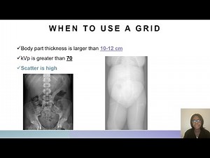 Image Production for the ARRT Registry Exam | Grids