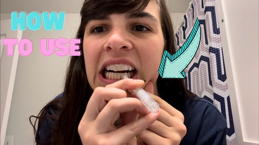 Watch How to use the smile direct club teeth whitening kit w/ LED on Amazon Live