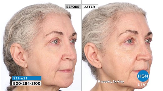 You are watching AeroPilates Home Studio on HSN.💙📺 Shop the show here: https://bit.ly/HSNRecentlyAired Catch up on the shows you missed and discover where shopping comes alive on the QVC & HSN Streaming Service: https://bit.ly/HSNplus | HSN