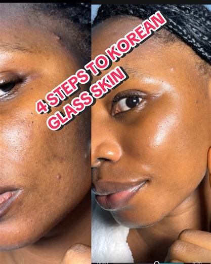 Effective Skin Reset with Aziik Skin RE:SET Program