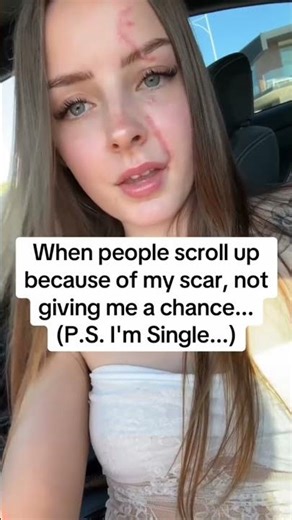 I'm single over 35 yo with scars on face #over50 #singlemoms