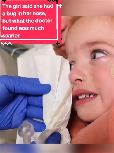 Doctor's Scary Discovery After Bug in Girl's Nose