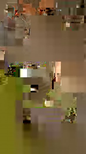 📍Deep Brain Stimulation (DBS) surgery is a highly effective method for suppressing the symptoms of Parkinson's disease and we are successfully performing it in our Neuromodulation Center. ❗DON’T BE LATE FOR TREATMENT❗ We wish you healthy days. 🙏 #deepbrainstimulation #dbs #parkinsonsdisease #drAtillaYılmaz #parkinson #neuromodulationinturkey #tremor #reels #reelsinstagram | Neuromodulation Center