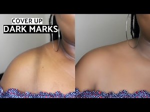 HOW TO COVER UP DARK MARKS FAST!!!