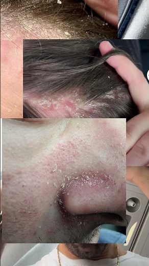 Seb Skincare – Calming Serum for Sensitive Skin