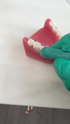 Ultrasonic Insert Adoption Tips For Sonic Toys