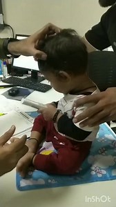 1.7M views · 10K reactions | Swelling in Neck.. Why?? #swelling...