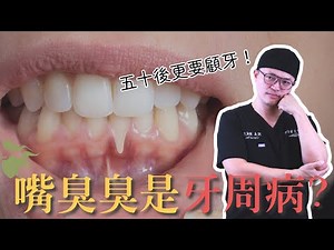 牙齒鬆掉不用怕！牙周再生手術救回自己的牙齒