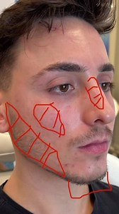 I ONLY Trust Dr. Emer with my Face