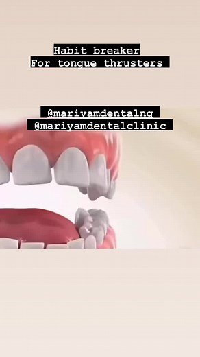 Understanding and Addressing Common Orthodontic Problems