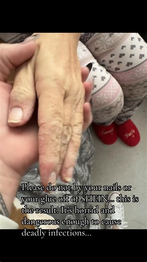 Warning About SHEIN Nail Products