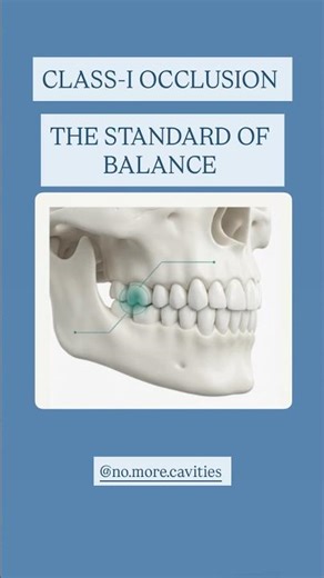 CLASS-1 OCCLUSION #dentaleducation #dentalprosthesis #dentist #dentalstudents #inbde #bds #dental