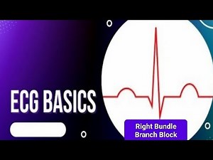 ECG Basics | Right Bundle Branch Block | Electrophysiology| Cause and Clinical significance of RBBB