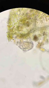 What’s Hiding Under the Microscope? Exploring the Tiny World