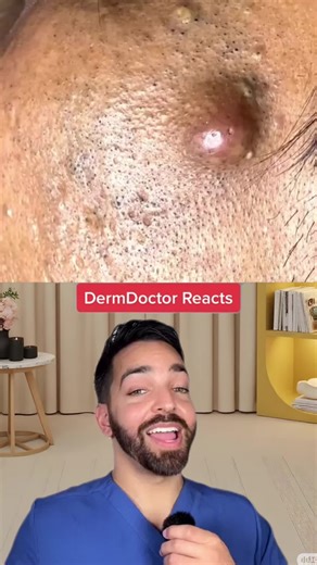 Effective Ways to Extract Ingrown Hair Bumps