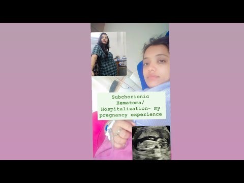 Subchorionic Hematoma in Pregnancy – My Scary But Hopeful Experience”