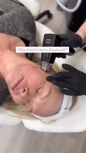 The Morpheus8 demonstration at our Grand Opening last month was a huge hit, and we loved getting to show how this treatment works for skin rejuvenation. Seeing the technology in action and being able to answer your questions in real time was such a great way to share what makes Morpheus8 one of our favourite options for stimulating collagen, skin tightening and improving texture and tone over time. We love Morpheus8 for ✨ boosting collagen ✨ minimizing pores ✨ improving skin texture ✨ contouring