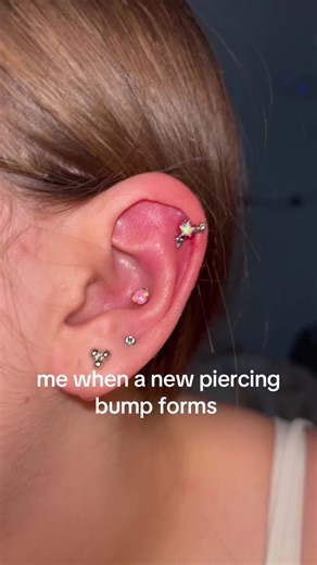Understanding Helix Piercing Bumps and Their Care