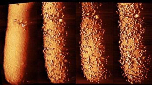 World-first images show antibiotics piercing evil bacteria's armor