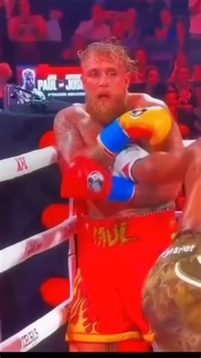 B.DONTPLAYTHATSHI on Instagram: "jack paul jaw after the boxing match #explorepage #fyp #jackpaul #boxing"