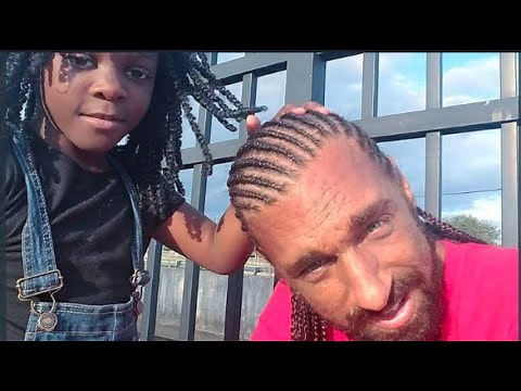 Pro-Black White Man Turning Black With Melanin Injections!