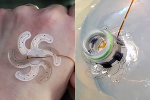 Innovative Soft Robot Has Tentacle-Like Electrodes to Monitor the Brain