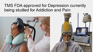 VIDEO: Technology vs. Pain and Addiction: Advances in Neuromodulation
