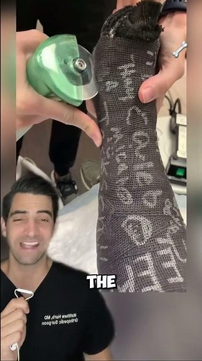 Watch this Cast Removal