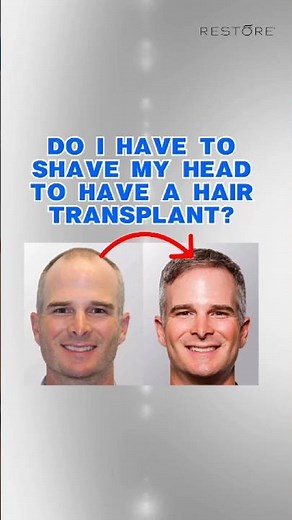 Dr. Harris Explains the Benefits of No-Shave FUE Hair Transplants ✨💇‍♂️ | Restore Hair
