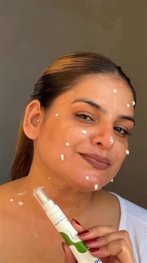 One pimple can ruin your mood, but the HiPer Succinic Zit Fix works fast to calm and shrink it. 🌿✨ After just a night, pimples look less red, less swollen, and easier to cover. @hiper.skin It’s lightweight, easy to apply, and gentle enough for everyday breakouts. A true acne-prone skin essential. 💖 (acne, acne care, salicylic acid, pimple, spot corrector, clear skin, acne positivity, acne community, dermatologist, acne problems) | Official_Rgmakeover