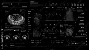 MRI x ray CT Scan.Medical HUD Analyzing cardiac diagnosis.DNA. Heard rate monitor. Futuristic Technological Interface. .Healthcare.
