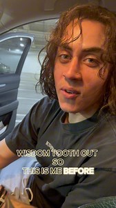 14K views · 863 reactions | Before and after wisdom teeth surgery礪 THIS DONT MEAN THE WORK STOPS I GOT SOMETHING FOR YALL SOON. HAPPY ALMOST WEEK I LOVE YALL礪❤️ Tour tickets : https://www.bandsintown.com/a/3576491-big-trip?utm_medium=web&utm_source=artist_event_page&utm_campaign=artist&came_from=209 | Big Trip | Facebook