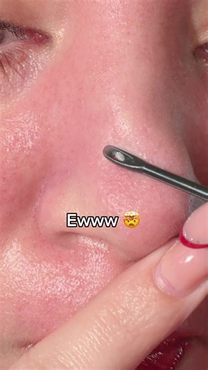 Effective Ways to Reduce Sebum and Filaments