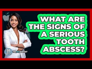 What Are The Signs Of A Serious Tooth Abscess?