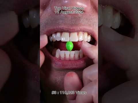 The Most Satisfying Chocolate and Candy ASMR Compilation 🍫🍬 #DoctorTristanPeh #Chocolate #Candy