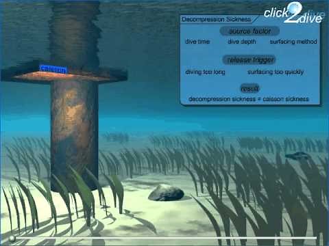 Decompression Sickness (1/2)