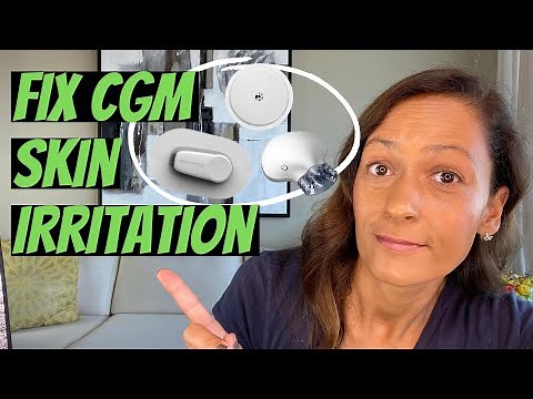 How to prevent skin irritation from CGM adhesive
