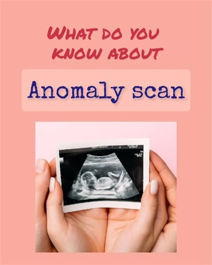 Anomaly Scan 🤰#anomalyscan #youtubeshorts #20weekspregnant