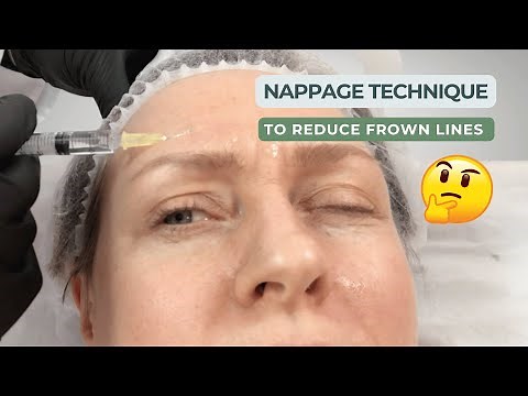 Mastering the Mesotherapy Nappage Method